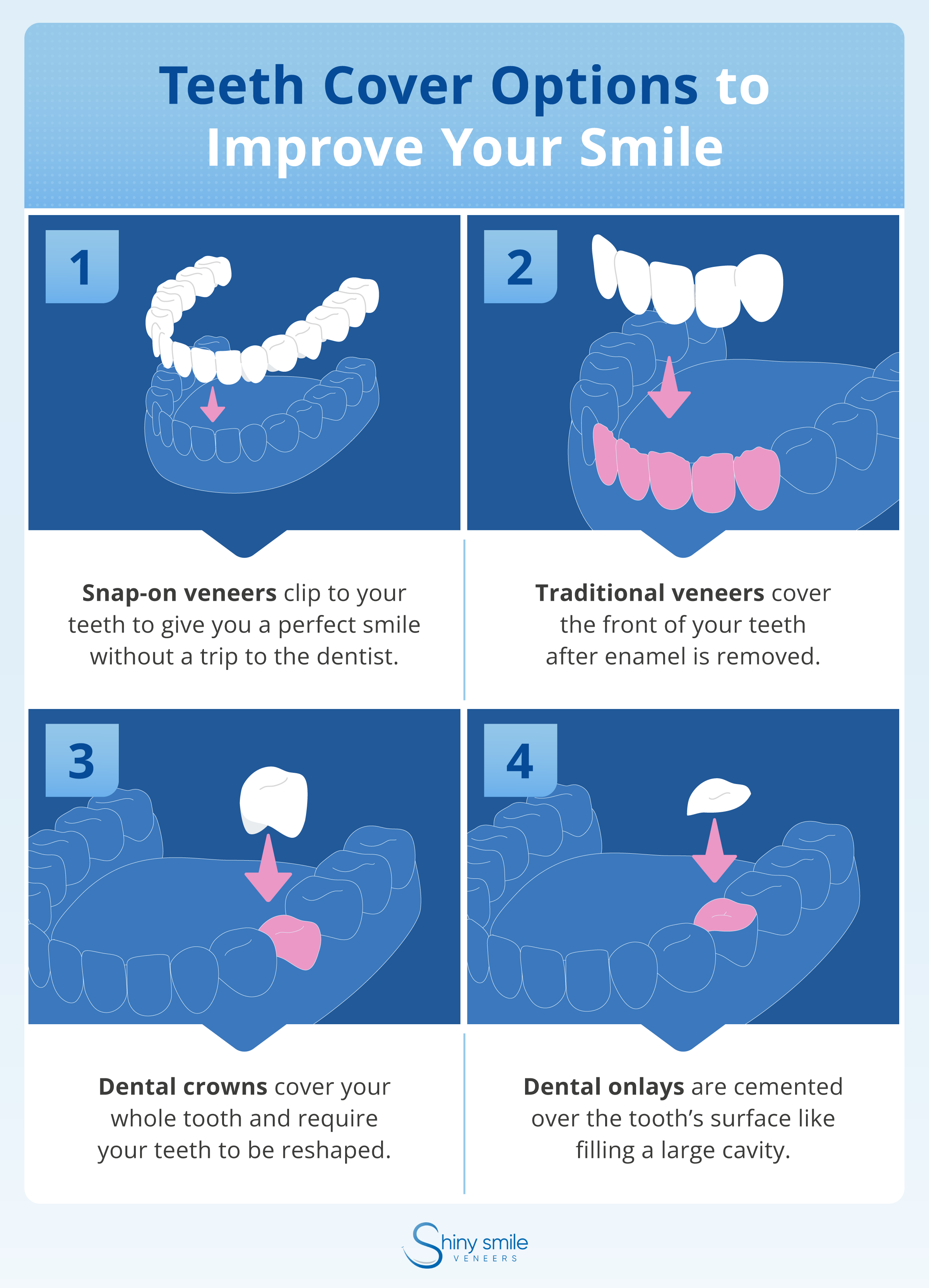 Smile Teeth Covers