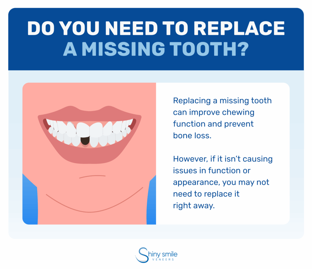 5 Best Tooth Replacement Options | Shiny Smile Veneers